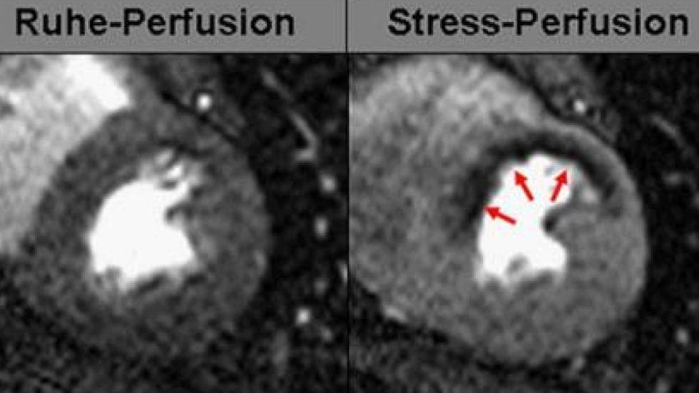Herz-MRT - Osypka Herzzentrum München