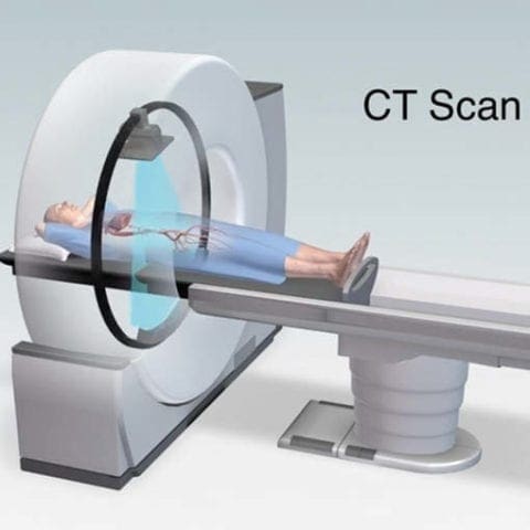 CT Lungenembolie - Osypka Herzzentrum München